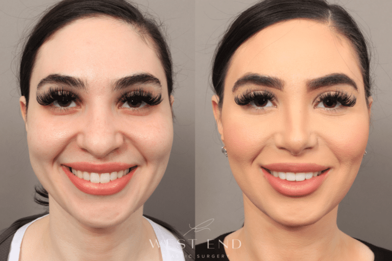 Lexie Wang, M.D. - West End Plastic Surgery